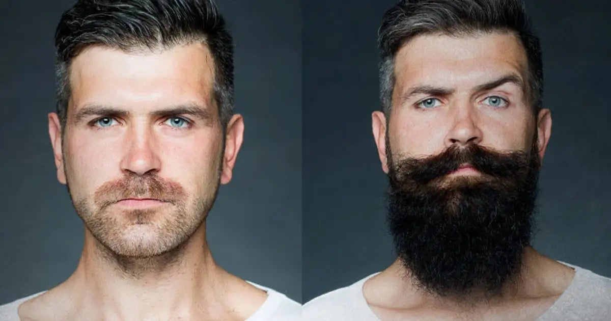 Tips to Speed Up the Beard Growth: What You Need to Know – BOSS BERRY